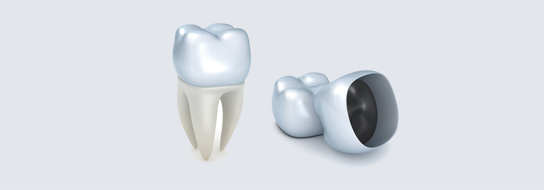 Dental Crowns Covina, CA | Premier Esthetics Dental Office of Mark R ...